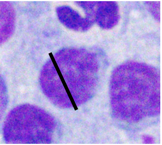 Cytologic Evaluation of Peripheral Lymph Node Aspirates