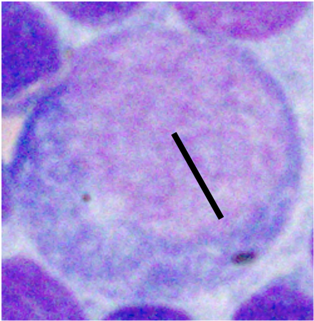 Cytologic Evaluation of Peripheral Lymph Node Aspirates
