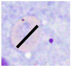 Cytologic Evaluation of Peripheral Lymph Node Aspirates