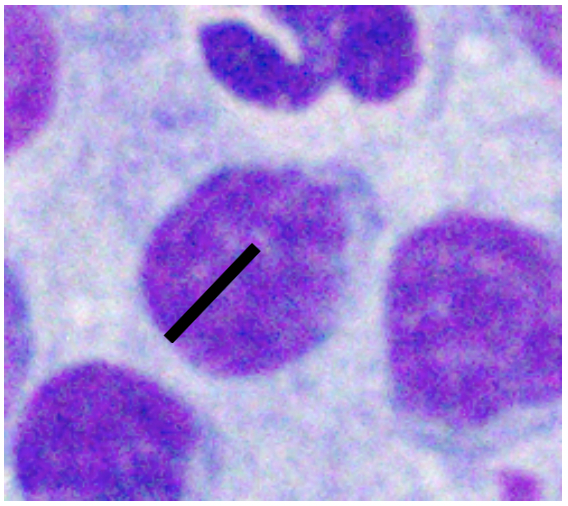 Cytologic Evaluation of Peripheral Lymph Node Aspirates