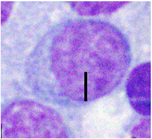 Cytologic Evaluation of Peripheral Lymph Node Aspirates