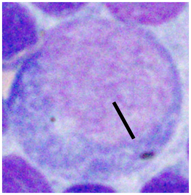 Cytologic Evaluation of Peripheral Lymph Node Aspirates