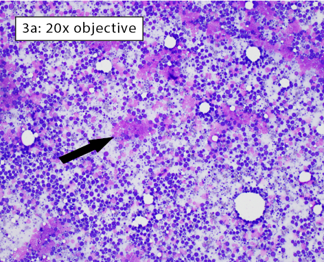 Cytologic Evaluation of Peripheral Lymph Node Aspirates