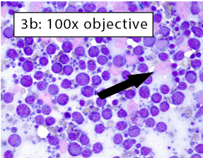 Cytologic Evaluation of Peripheral Lymph Node Aspirates