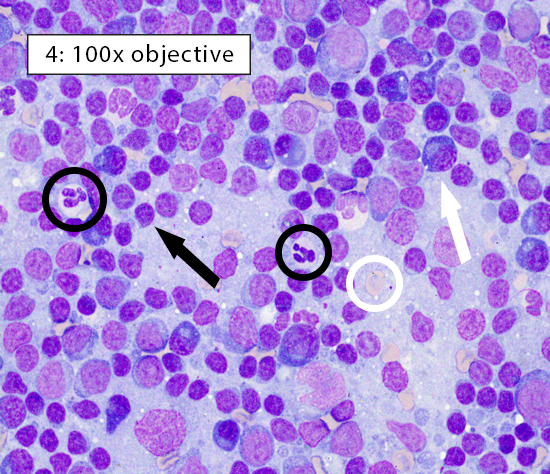 Cytologic Evaluation of Peripheral Lymph Node Aspirates