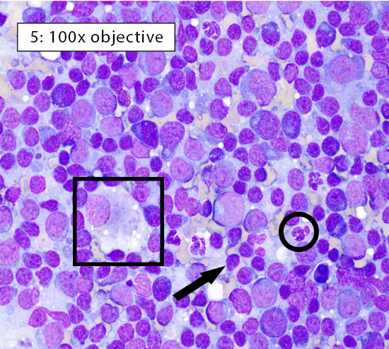Cytologic Evaluation of Peripheral Lymph Node Aspirates