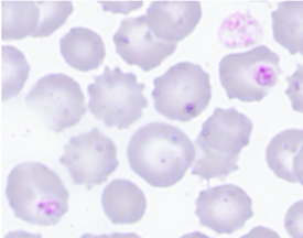 FAKE OUT! Hemoparasite or Blood Smear Artifact?