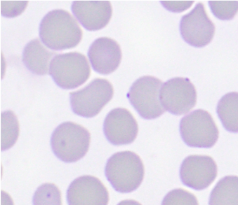FAKE OUT! Hemoparasite or Blood Smear Artifact?