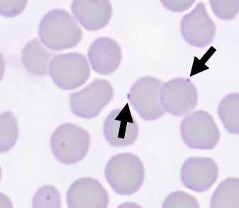 FAKE OUT! Hemoparasite or Blood Smear Artifact?