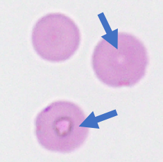 FAKE OUT! Hemoparasite or Blood Smear Artifact?