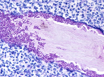 The Diagnosis of Fungal Kerion in Dogs