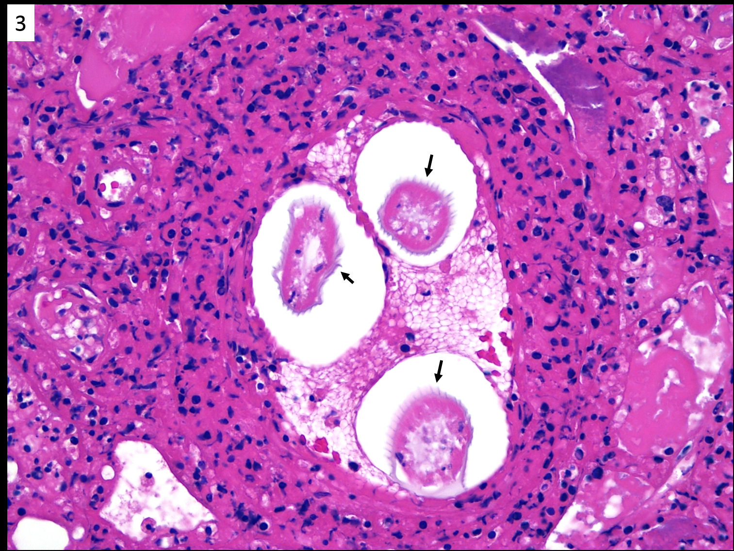 Cutaneous Habronemiasis in a Horse