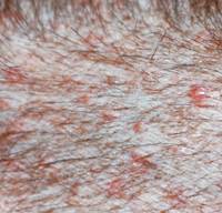 Canine Bacterial Pyoderma: Indications and Skin Sampling Techniques